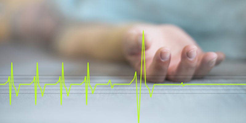 What Is a Level 3 Sleep Study & How We Assess the Data